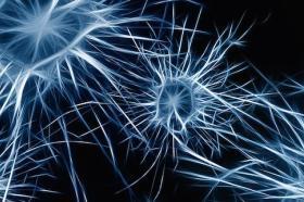 Computational Psychology and Artificial Intelligence | Lady Margaret Hall